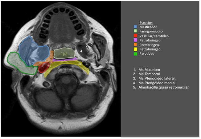 patología faringe - Clínica Gálvez