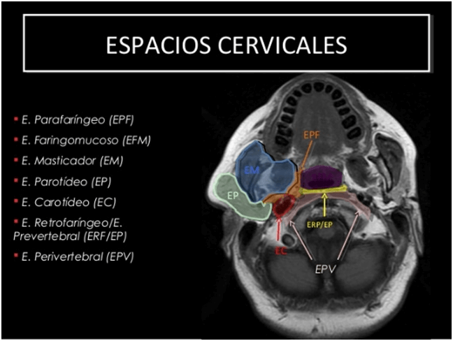 patología faringe - Clínica Gálvez